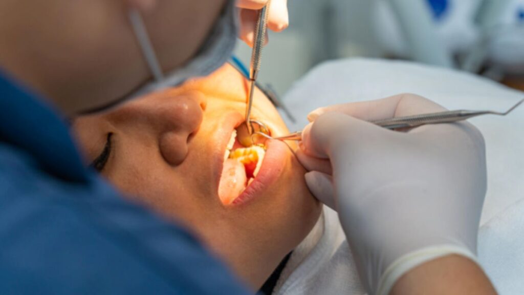 Everything You Need to Know About Oral Surgery
